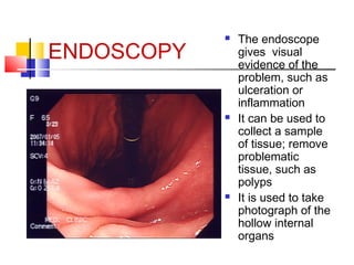 Endoscopy | PPT