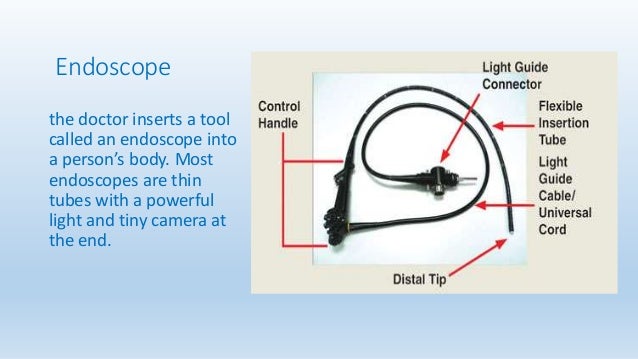 Endoscopy and types of endoscopy