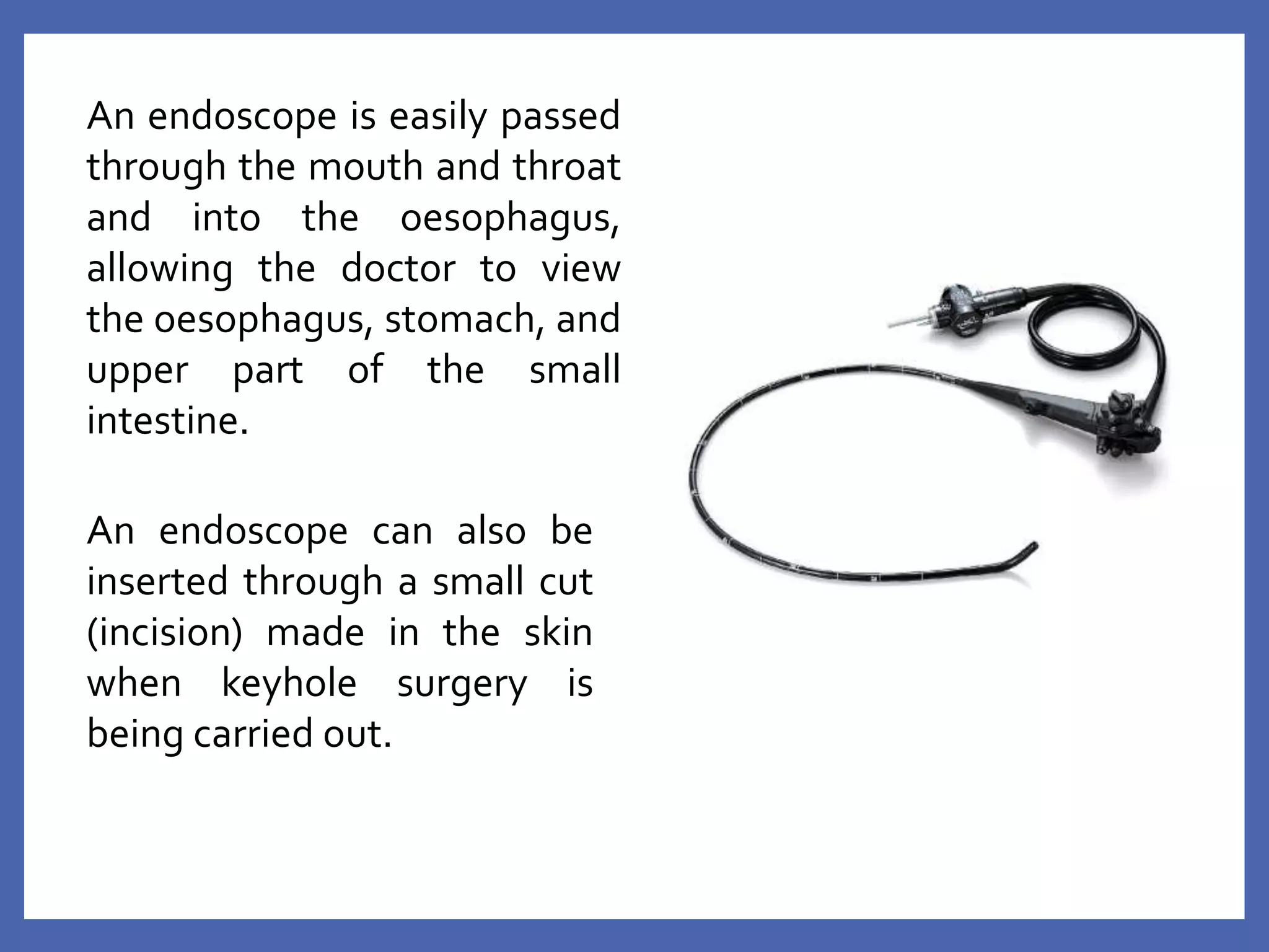 Endoscopy | PPT