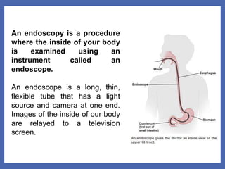 Endoscopy | PPTX