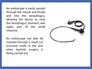 Endoscopy | PPTX