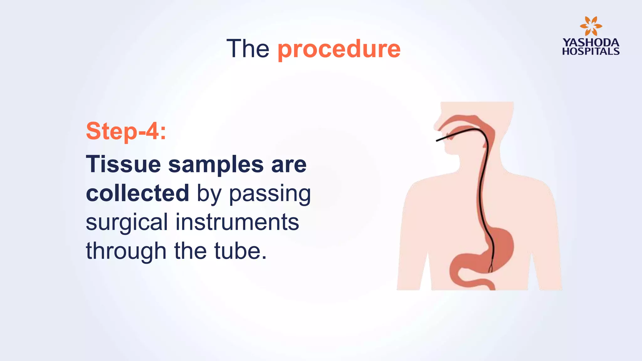 Endoscopy: Types, Preparation, Diagnosis, Procedure and Risks | PPTX