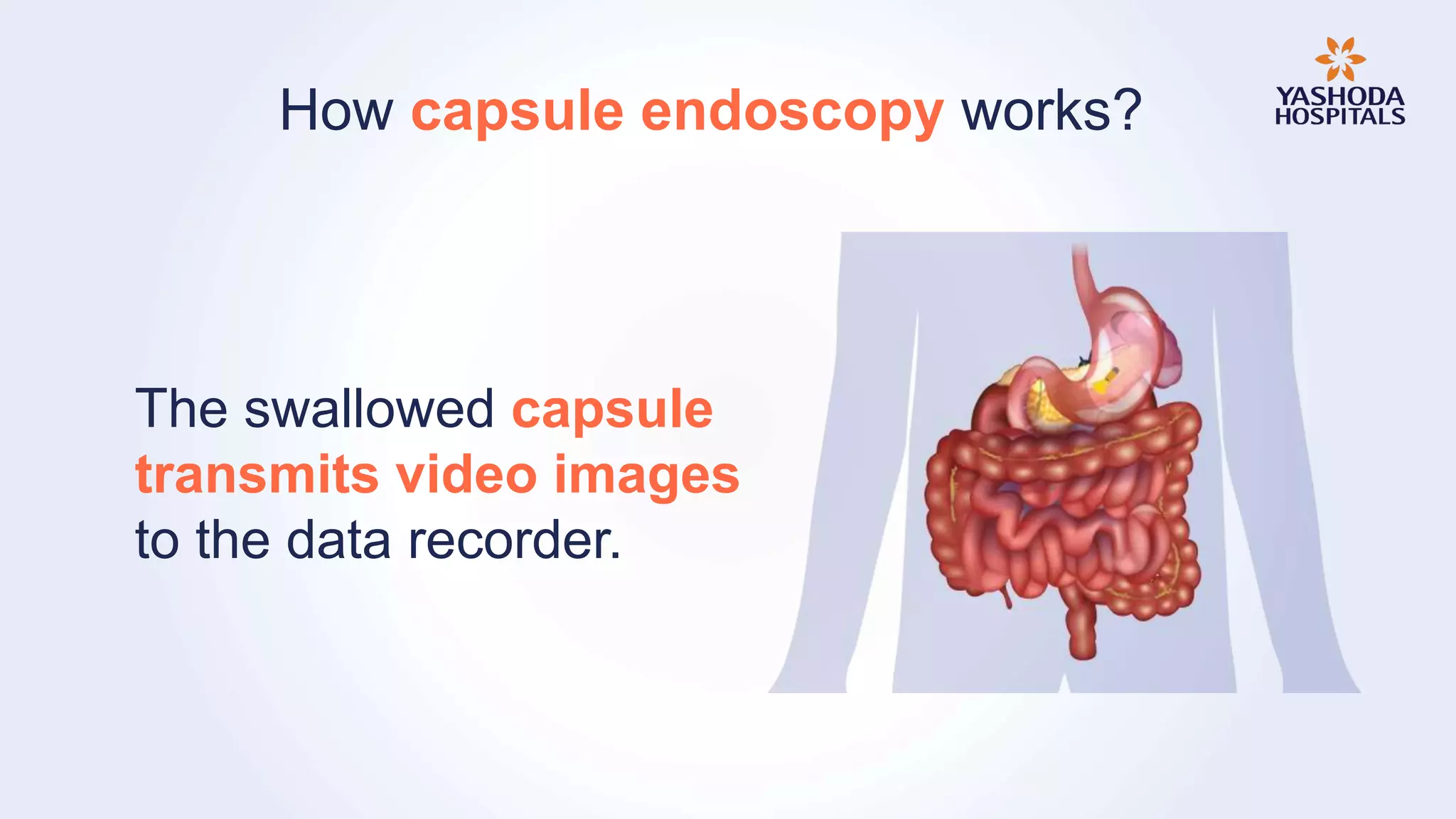 Endoscopy: Types, Preparation, Diagnosis, Procedure and Risks | PPTX