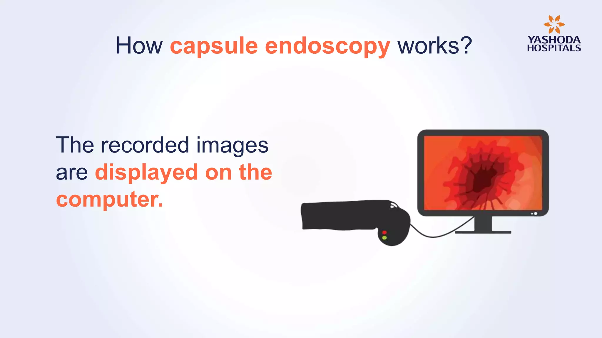 Endoscopy: Types, Preparation, Diagnosis, Procedure and Risks | PPTX