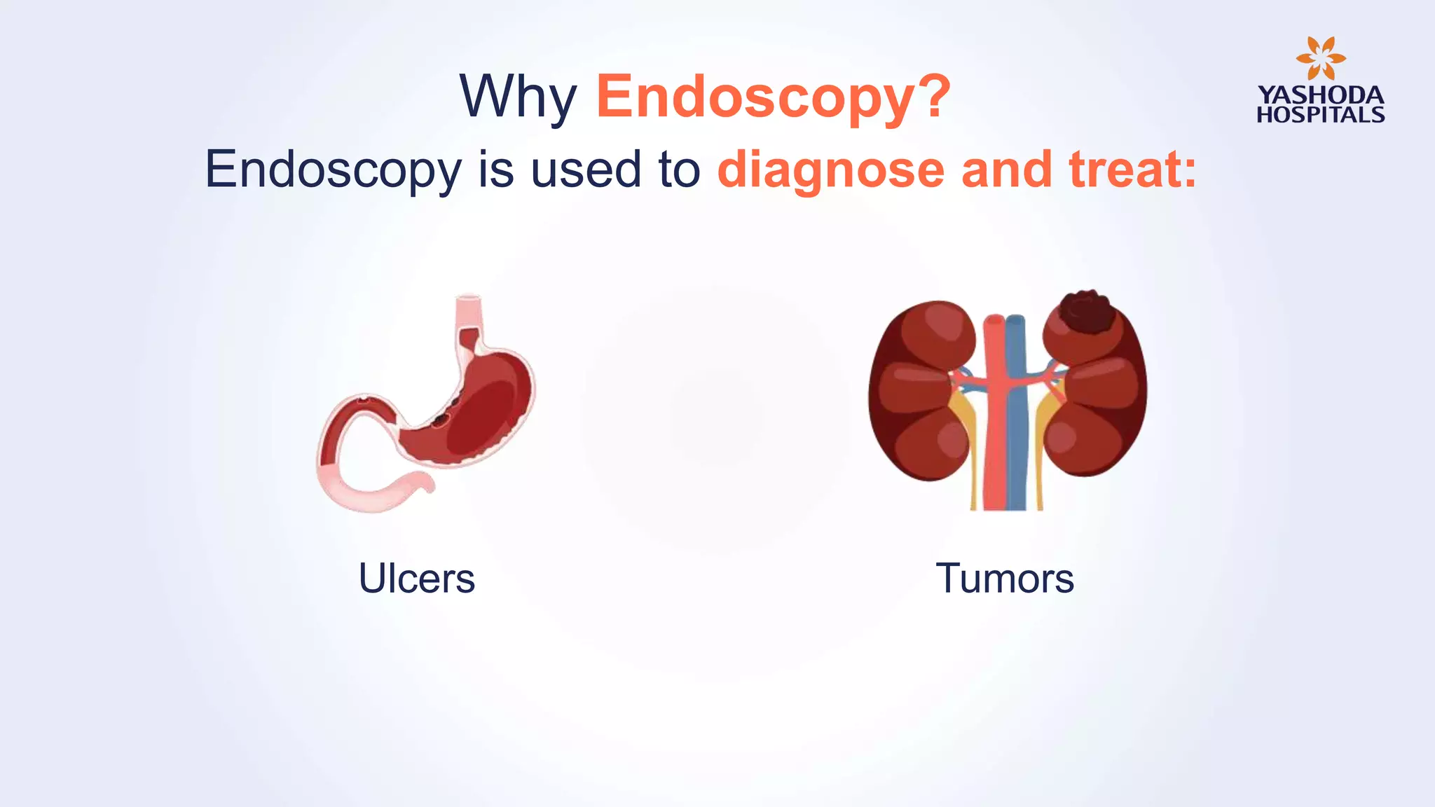 Endoscopy: Types, Preparation, Diagnosis, Procedure and Risks | PPTX