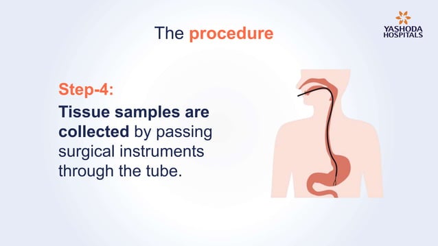 Endoscopy: Types, Preparation, Diagnosis, Procedure and Risks | PPTX ...