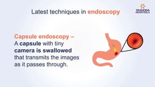 Endoscopy: Types, Preparation, Diagnosis, Procedure and Risks | PPTX