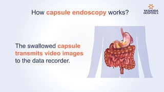Endoscopy: Types, Preparation, Diagnosis, Procedure and Risks | PPTX