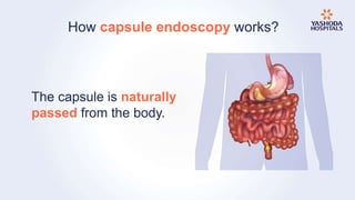 Endoscopy: Types, Preparation, Diagnosis, Procedure and Risks | PPTX