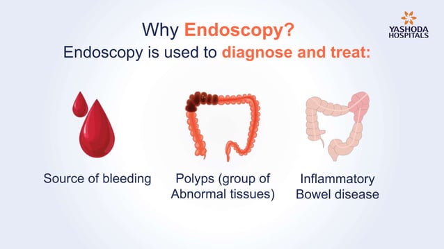 Endoscopy: Types, Preparation, Diagnosis, Procedure and Risks | PPTX ...