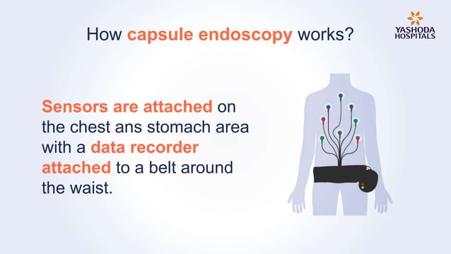 Endoscopy: Types, Preparation, Diagnosis, Procedure and Risks | PPT
