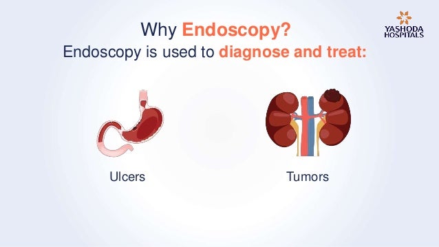 Endoscopy: Types, Preparation, Diagnosis, Procedure and Risks