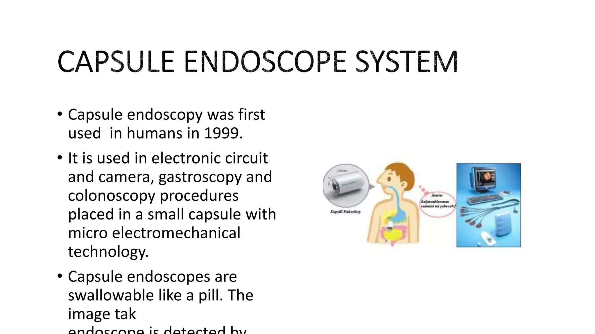 Endoscopy | PPTX