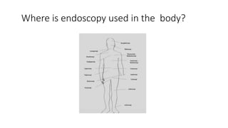 Endoscopy | PPTX