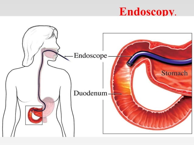 Endoscopy.pptx