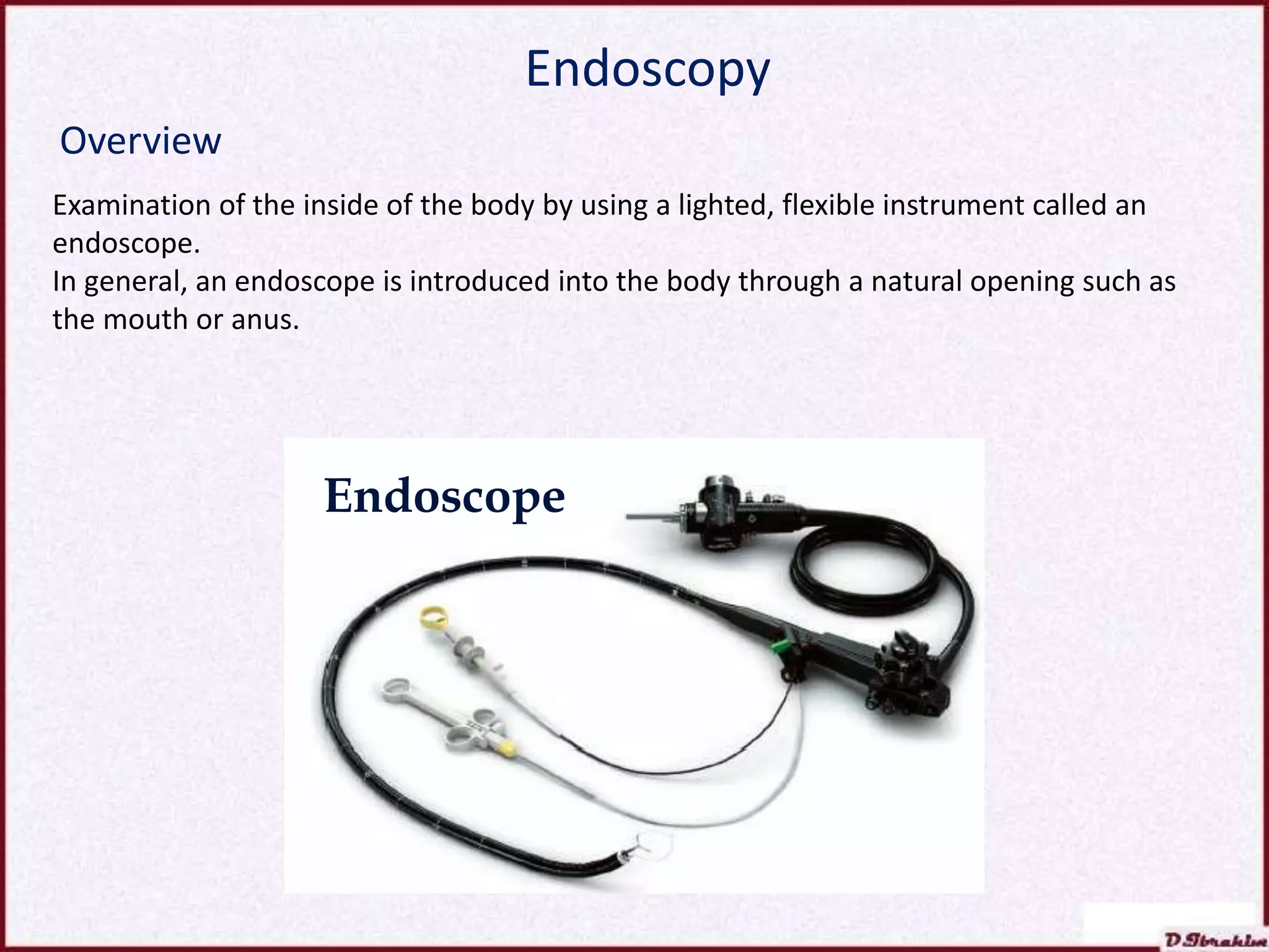 Endoscopy helminth.pptx