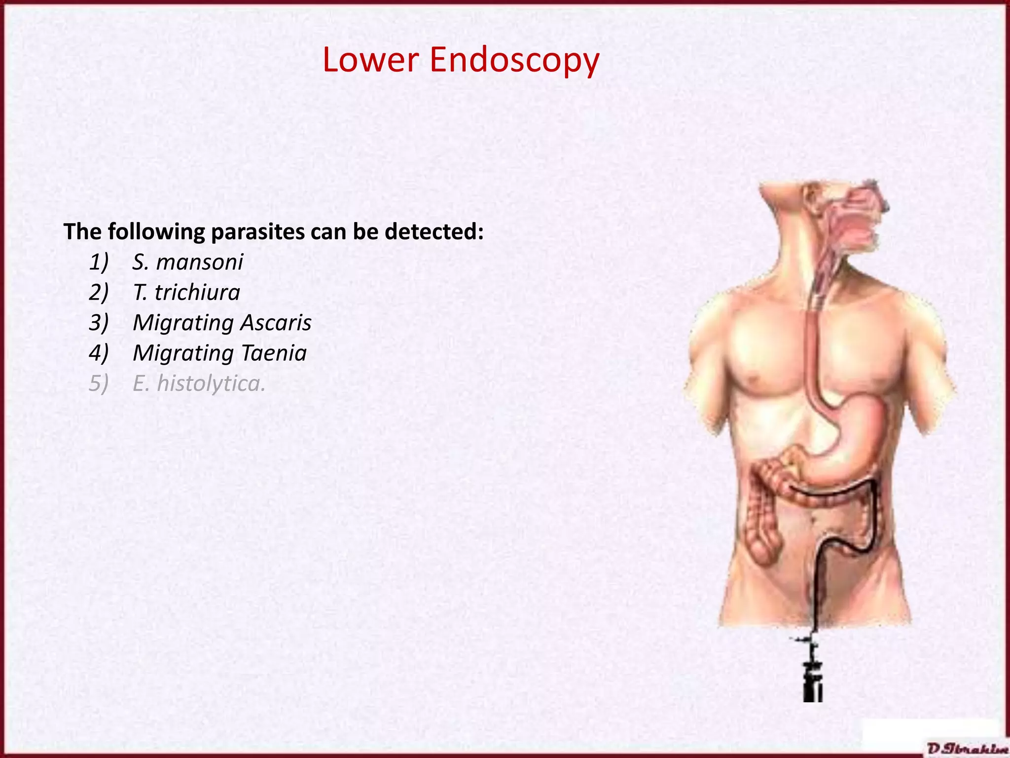 Endoscopy helminth.pptx
