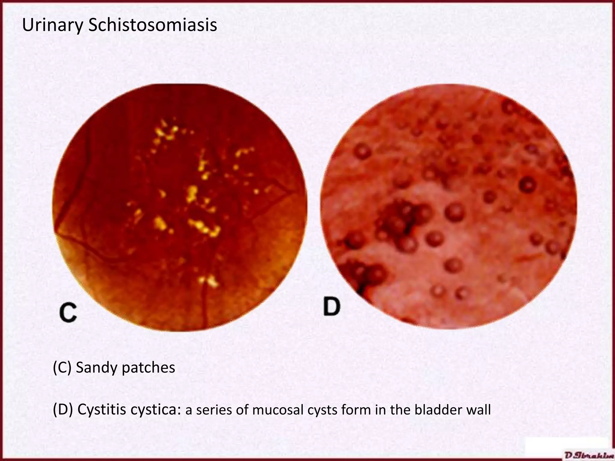 Endoscopy helminth.pptx