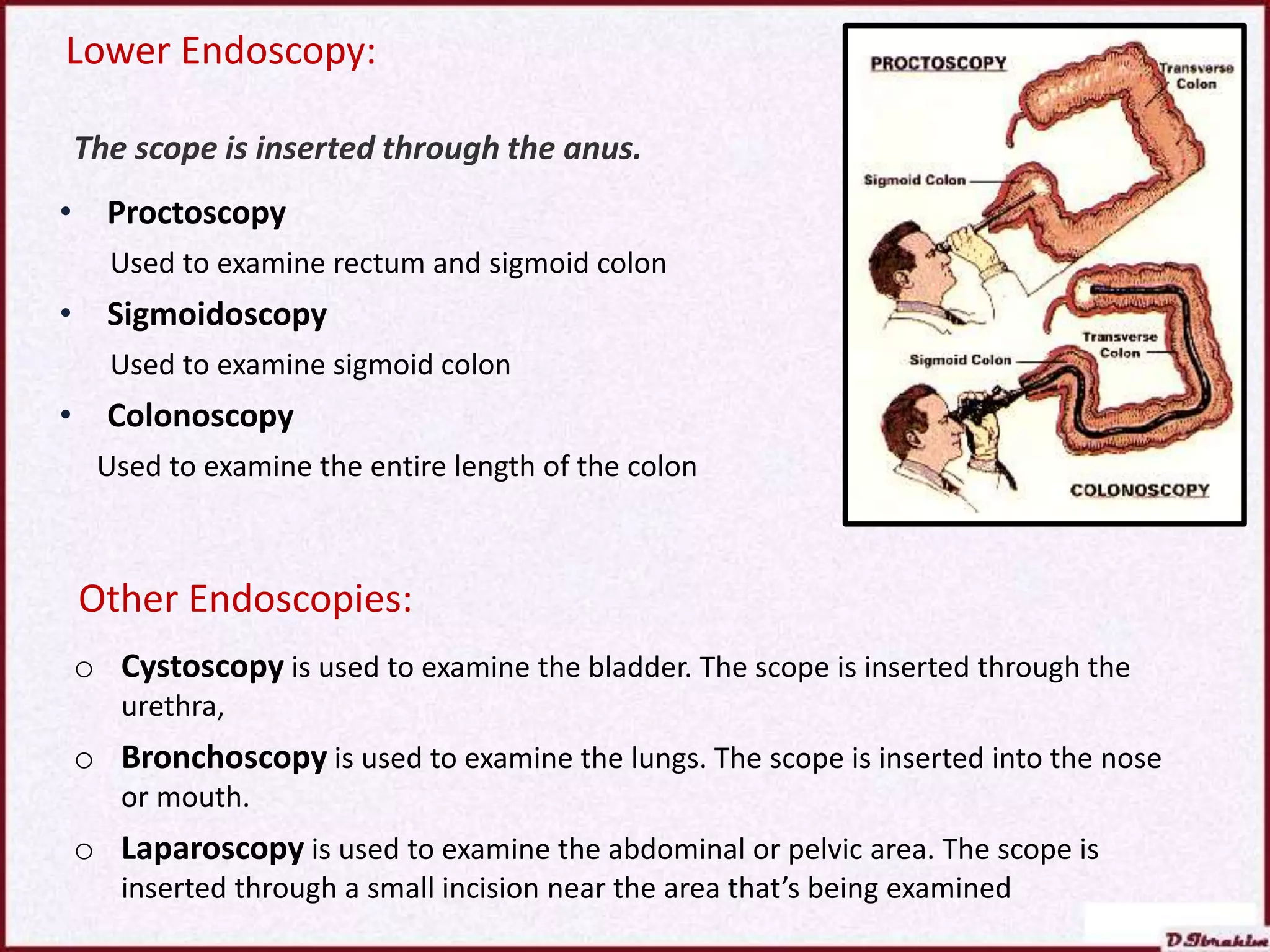 Endoscopy helminth.pptx