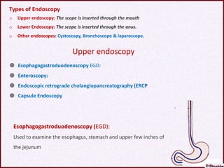 Endoscopy helminth.pptx