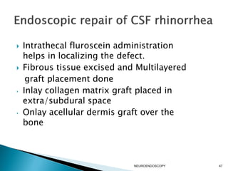 Endoscopy in cranial and skull base surgery | PDF