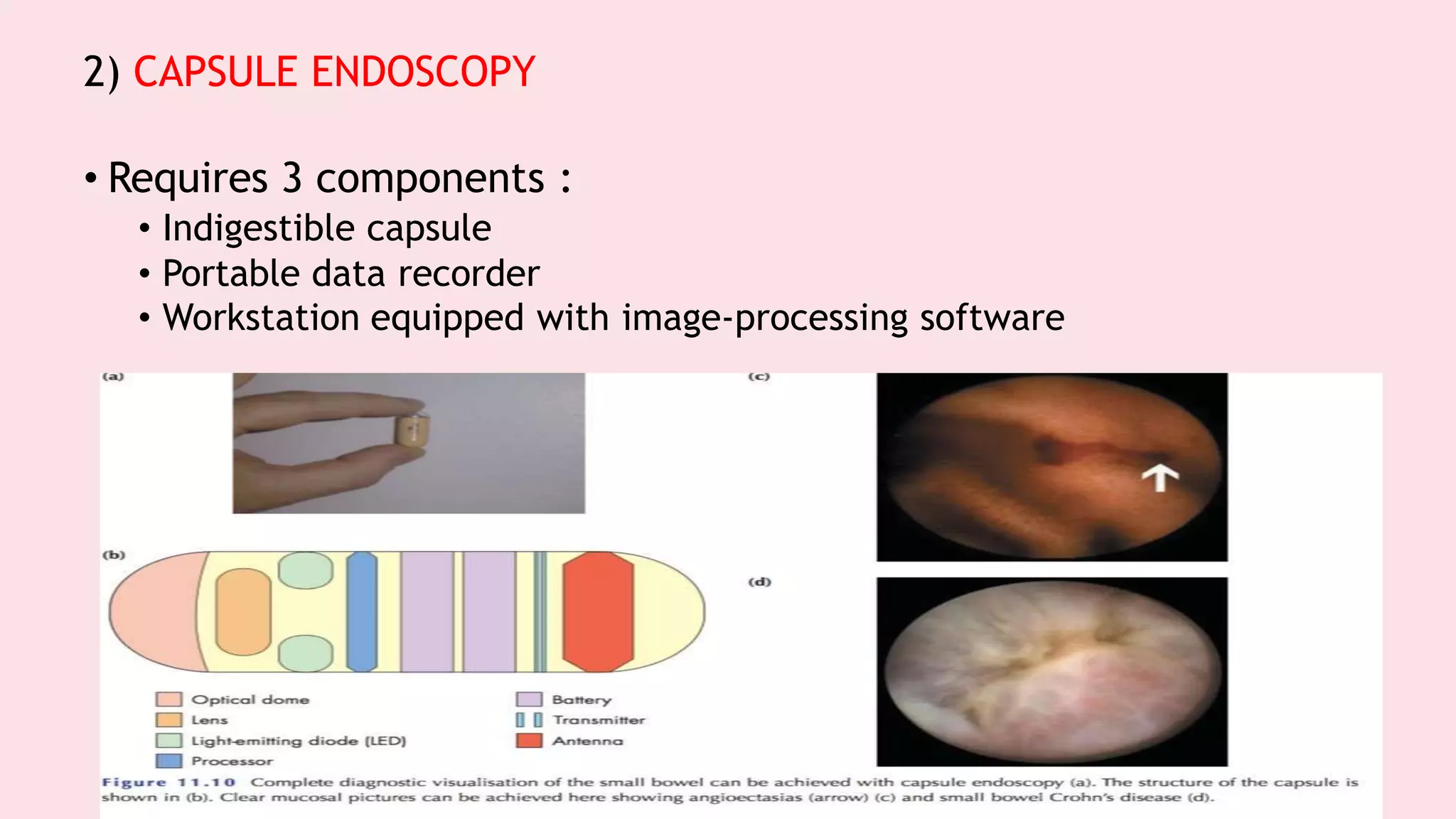 Endoscopy in surgery | PPTX
