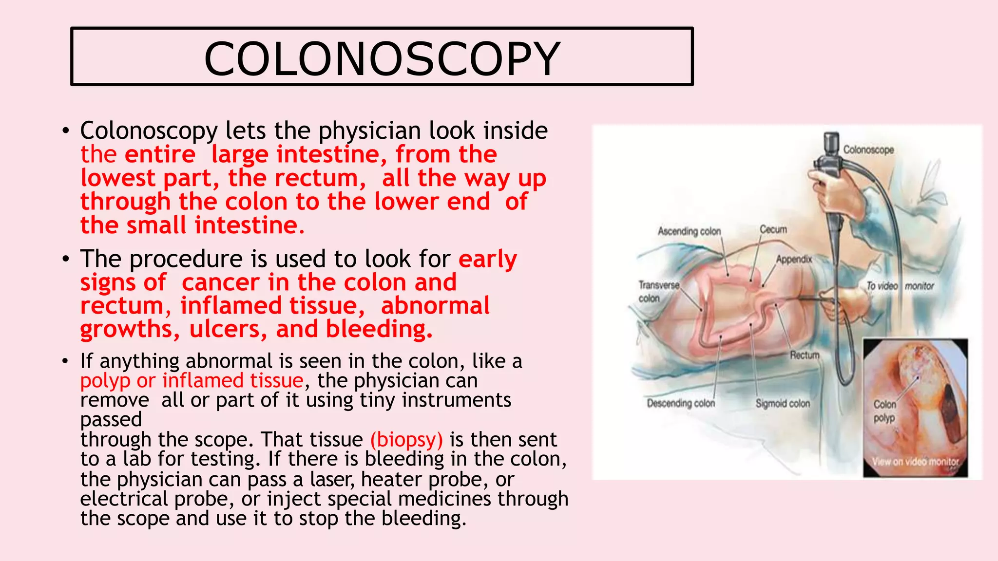 Endoscopy in surgery | PPTX