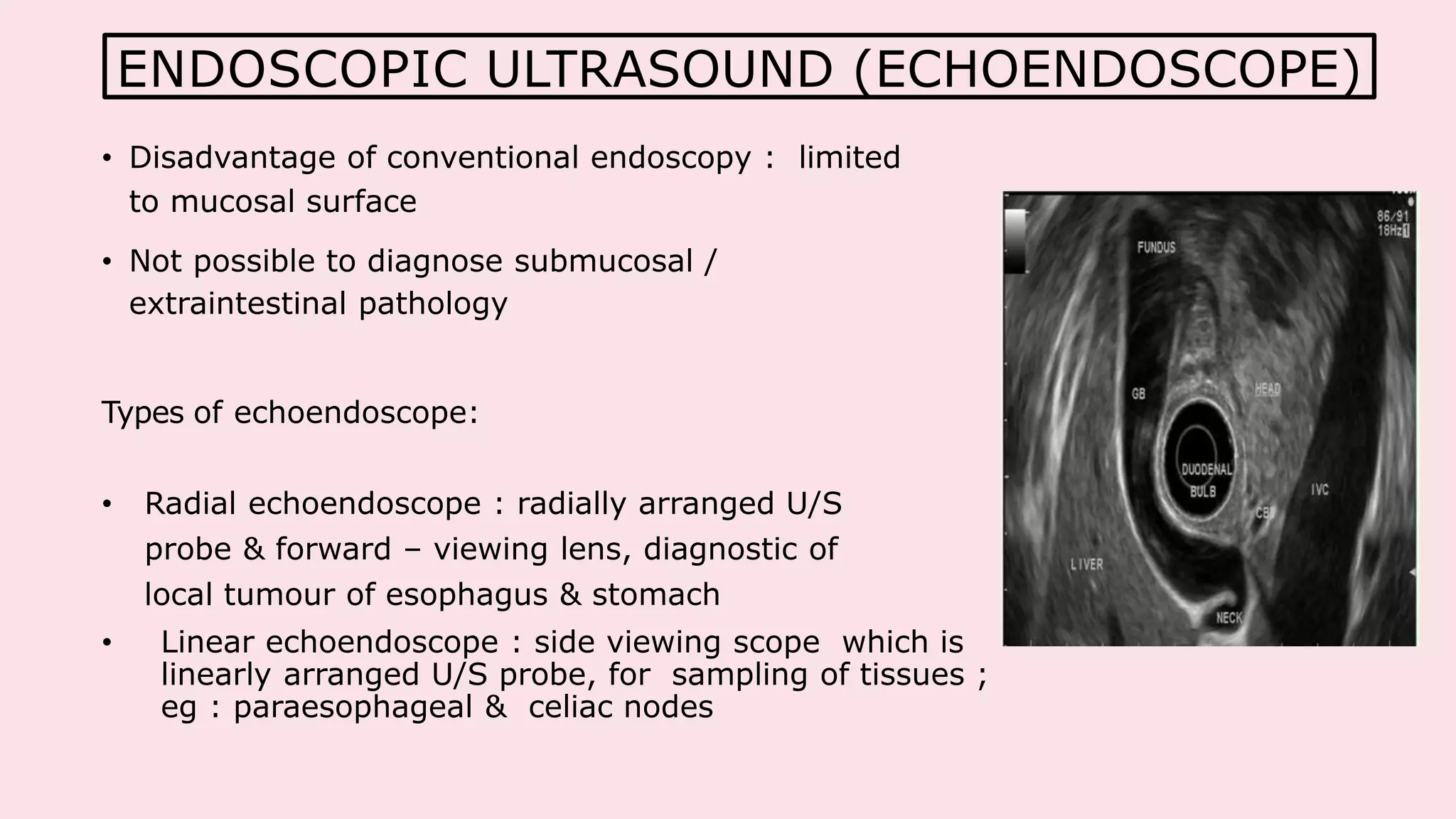 Endoscopy in surgery | PPTX