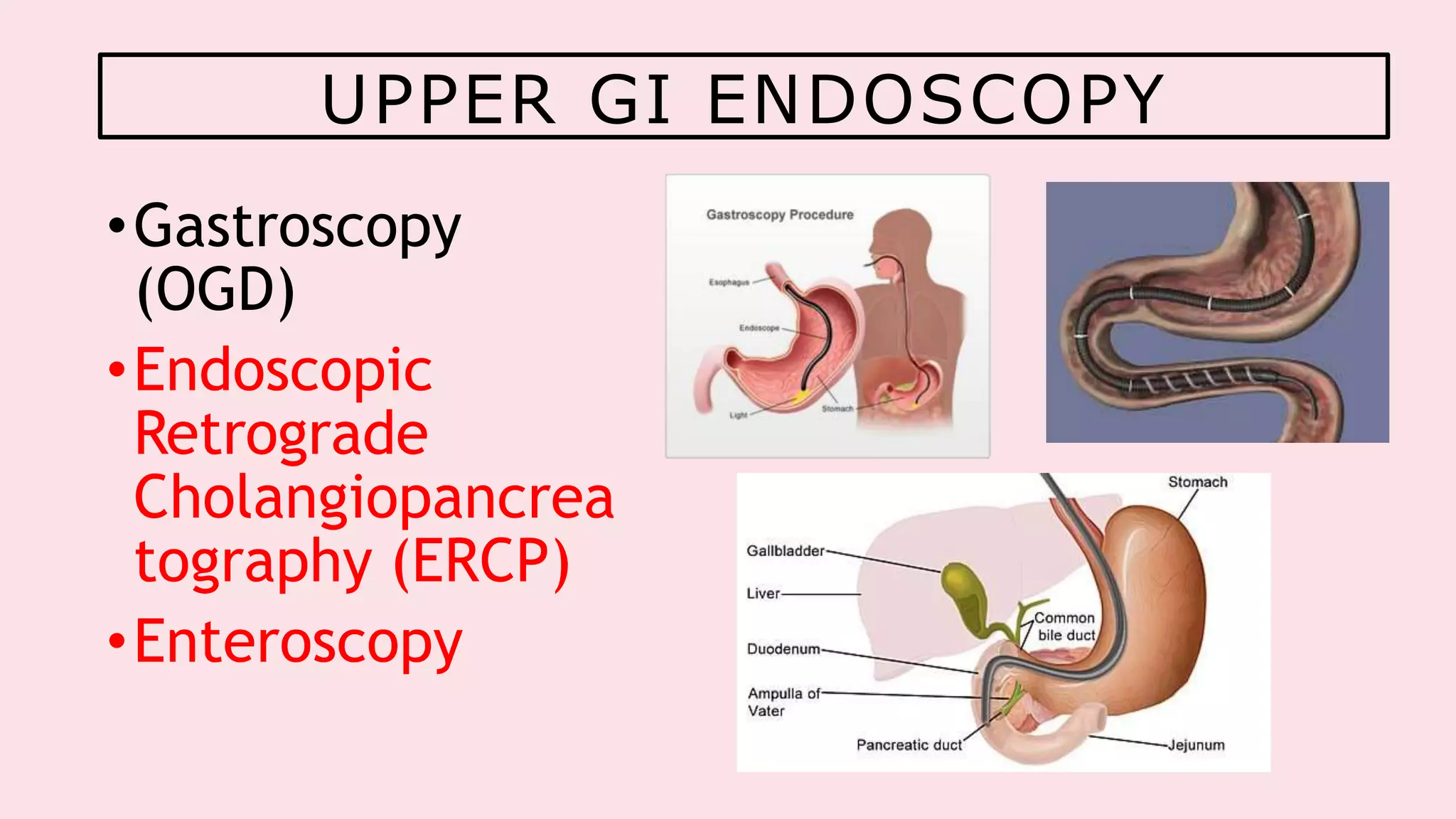 Endoscopy in surgery | PPTX