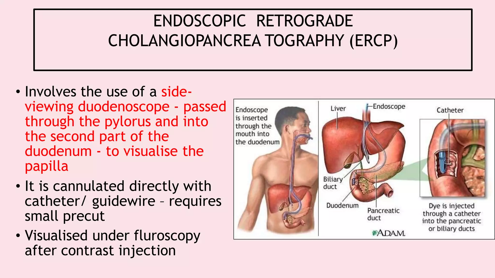 Endoscopy in surgery | PPTX