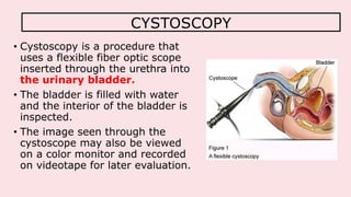Endoscopy in surgery | PPTX