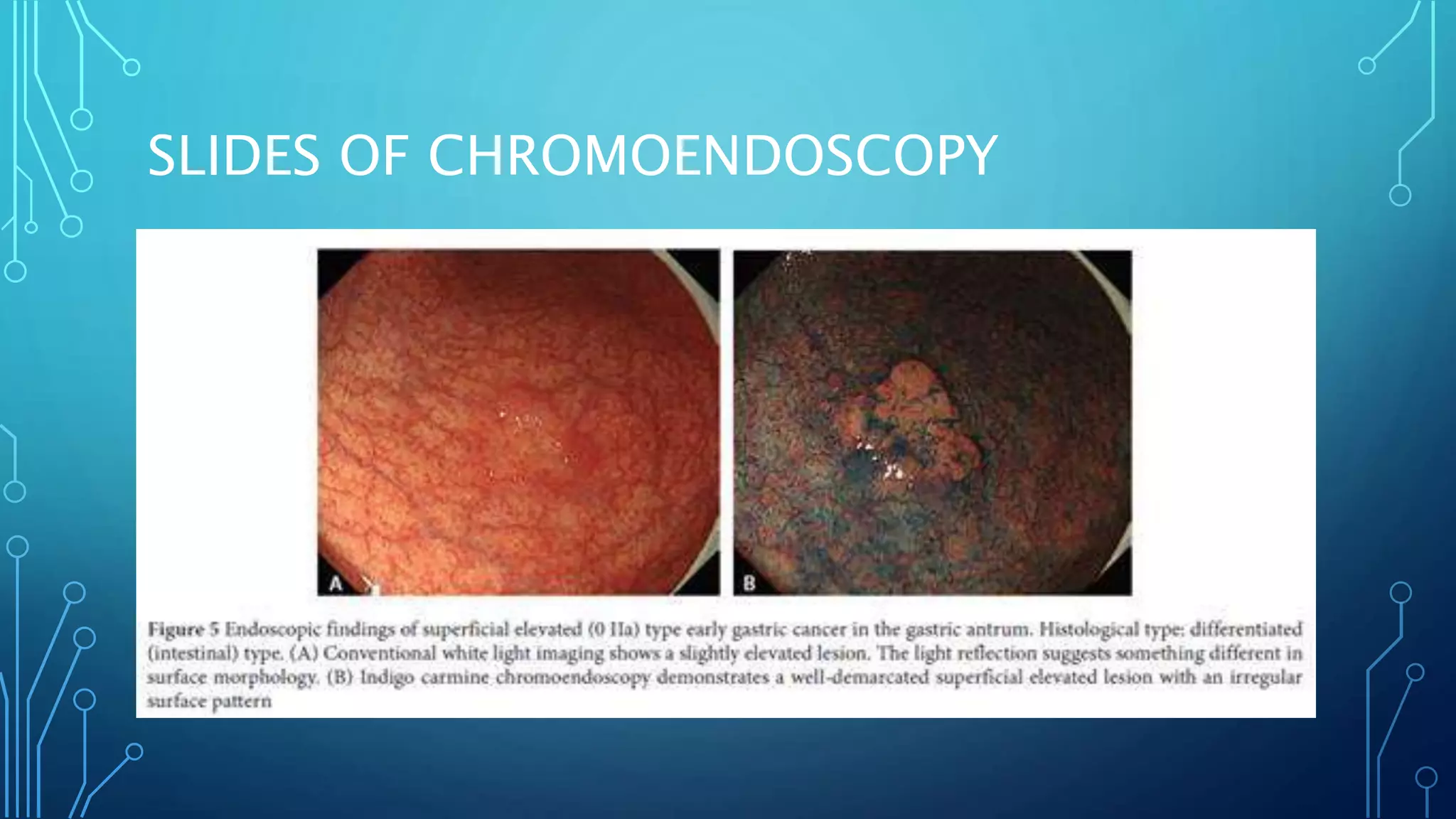 Endoscopy in surgical practice.pptx