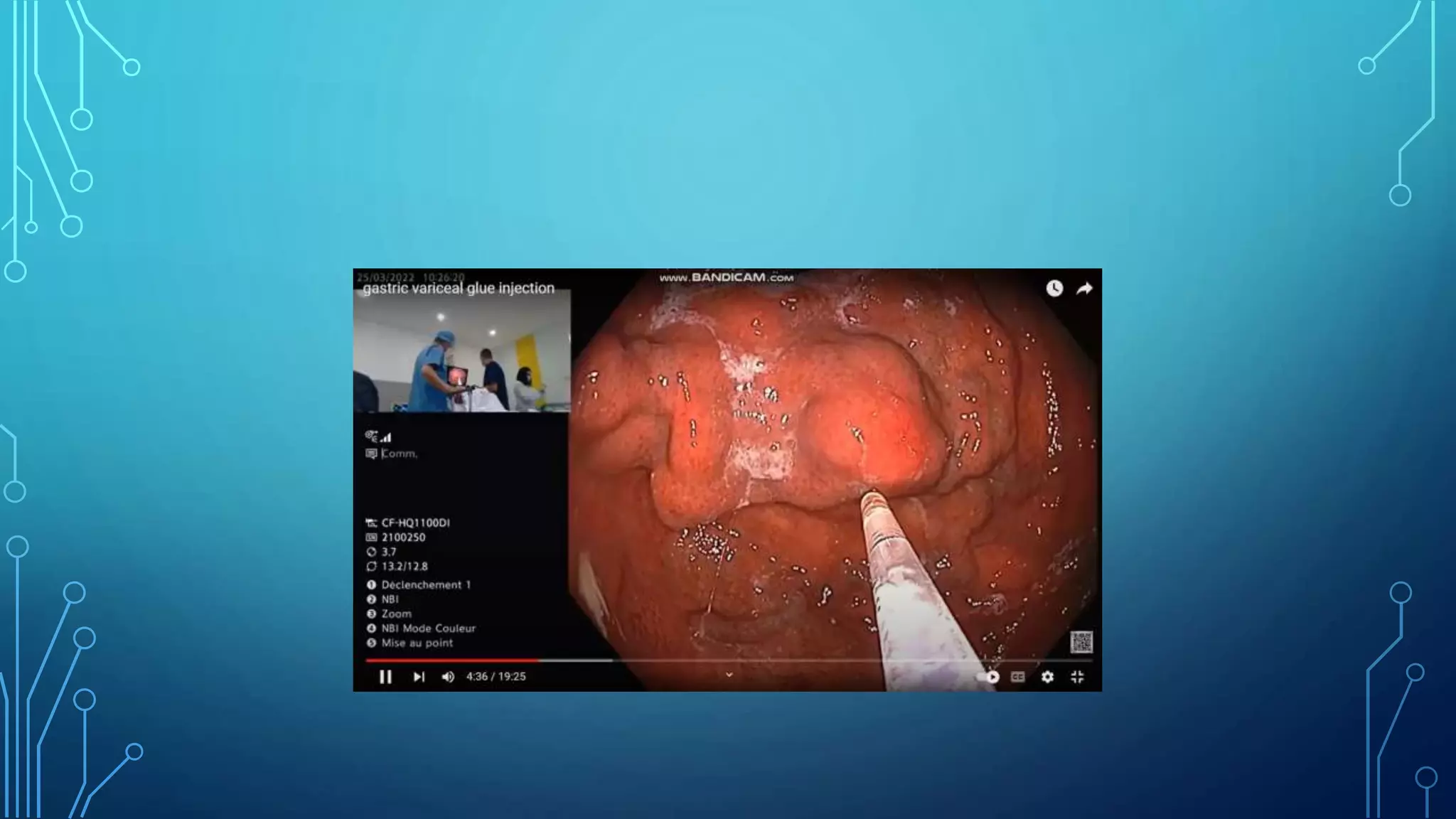 Endoscopy in surgical practice.pptx