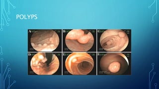 Endoscopy in surgical practice.pptx