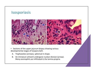 Endoscopy Protoz;a.pptx