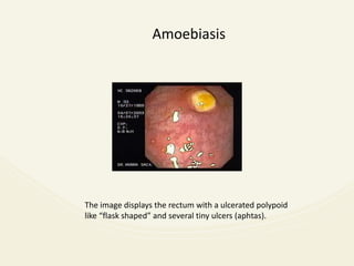 Endoscopy Protoz;a.pptx