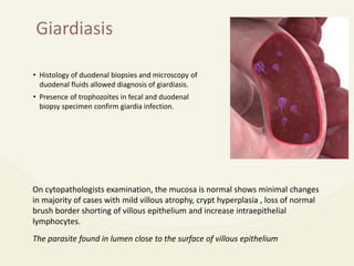 Endoscopy Protoz;a.pptx