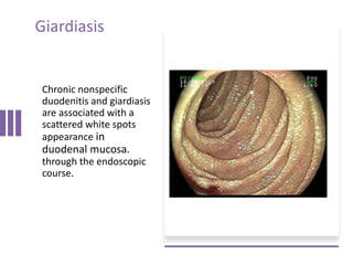 Endoscopy Protoz;a.pptx