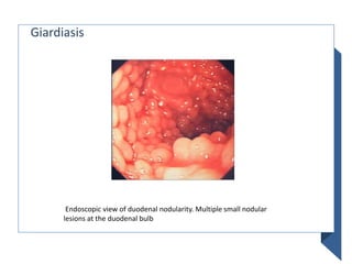 Endoscopy Protoz;a.pptx