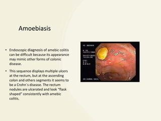 Endoscopy Protoz;a.pptx