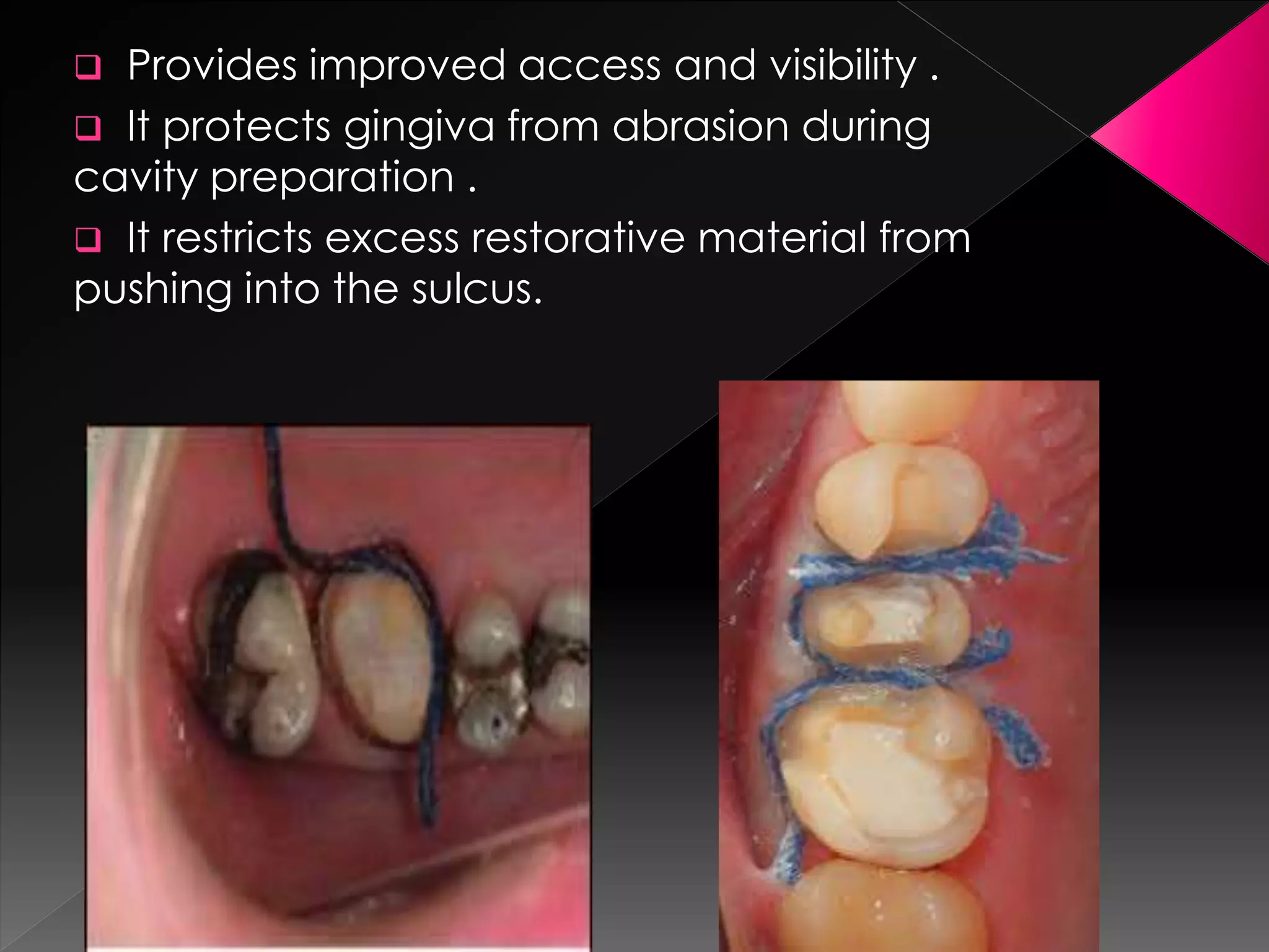 isolation in endodontics | PPTX
