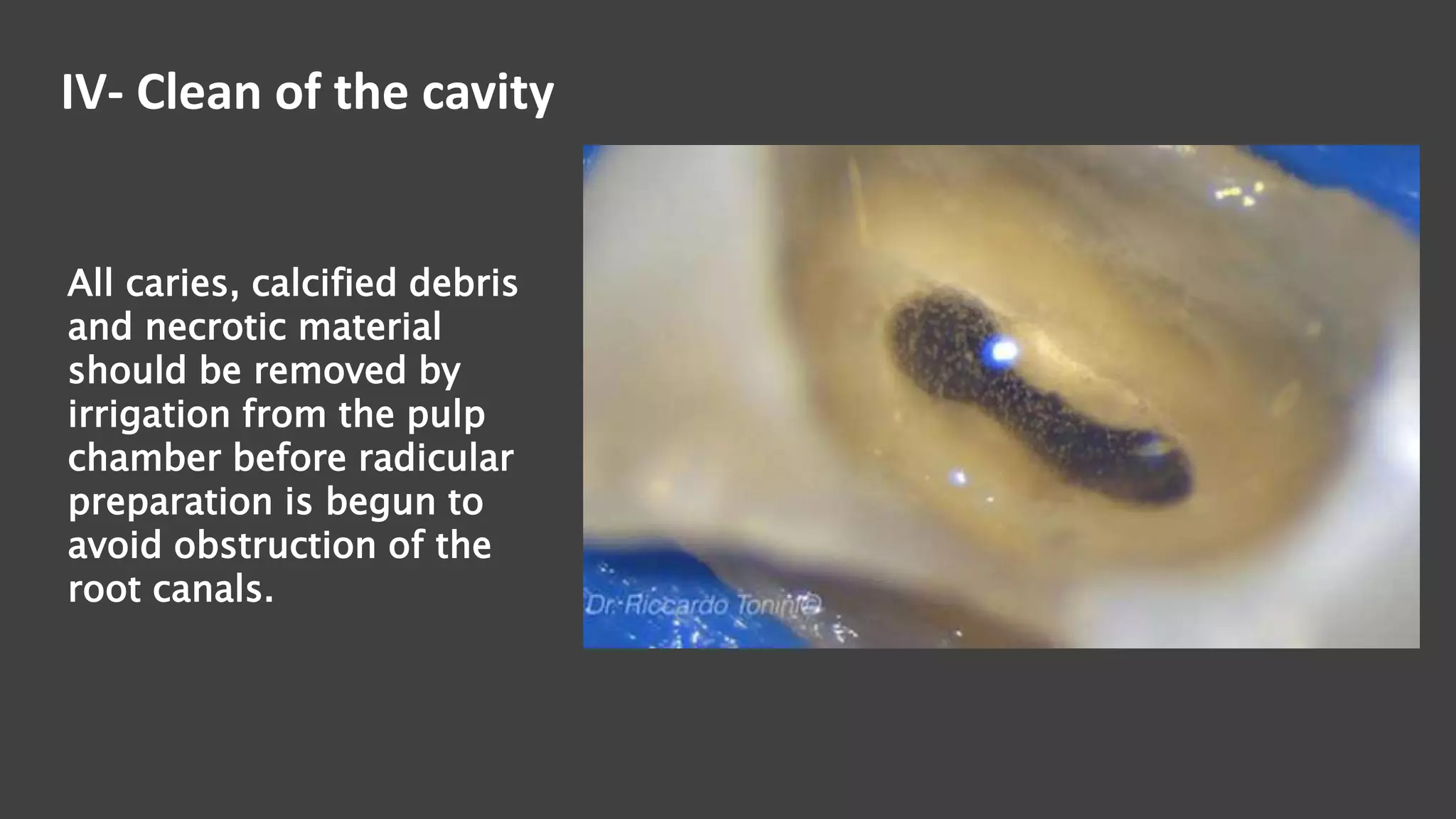 Endodontic access cavity for anterior teeth Dr. Ali Mohammed | PPTX