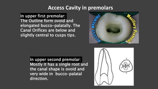Endodontic access cavity for anterior teeth Dr. Ali Mohammed | PPTX