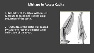 Endodontic access cavity for anterior teeth Dr. Ali Mohammed | PPTX