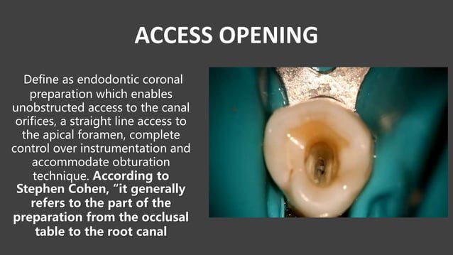Endodontic access cavity for anterior teeth Dr. Ali Mohammed | PPTX