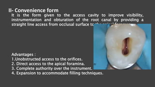 Endodontic access cavity for anterior teeth Dr. Ali Mohammed | PPTX