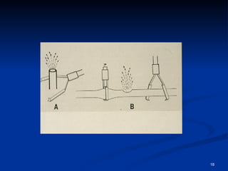 Endoskopska Diagnostika In Zdravljenje Bolezni Prebavil | PPT