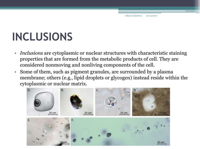 Endosomes.Peroxisomes. Proteasomes Cytoplasmic inclusions | PPTX ...