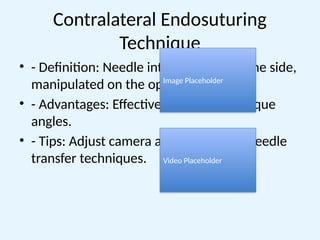 Endosuturing_Tips_and_Tricks_With_Placeholders.pptx