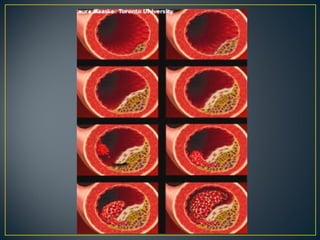 Endotelio vascular | PPT